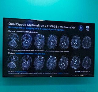 MR innovations | フィリップスヘルスケア