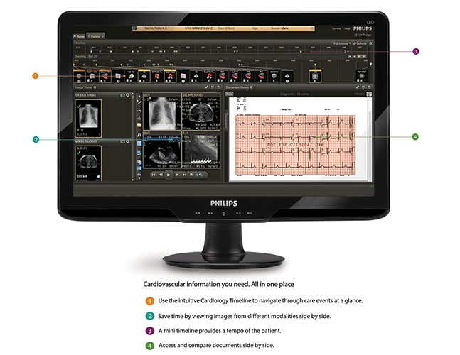 Cardiovascular Information Systems | Clinical Informatics | Philips Healthcare