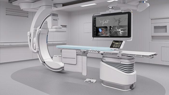 腫瘍塞栓術 | フィリップスヘルスケア