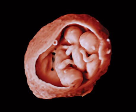 OB/GYN向け超音波診断装置 | Philips Healthcare